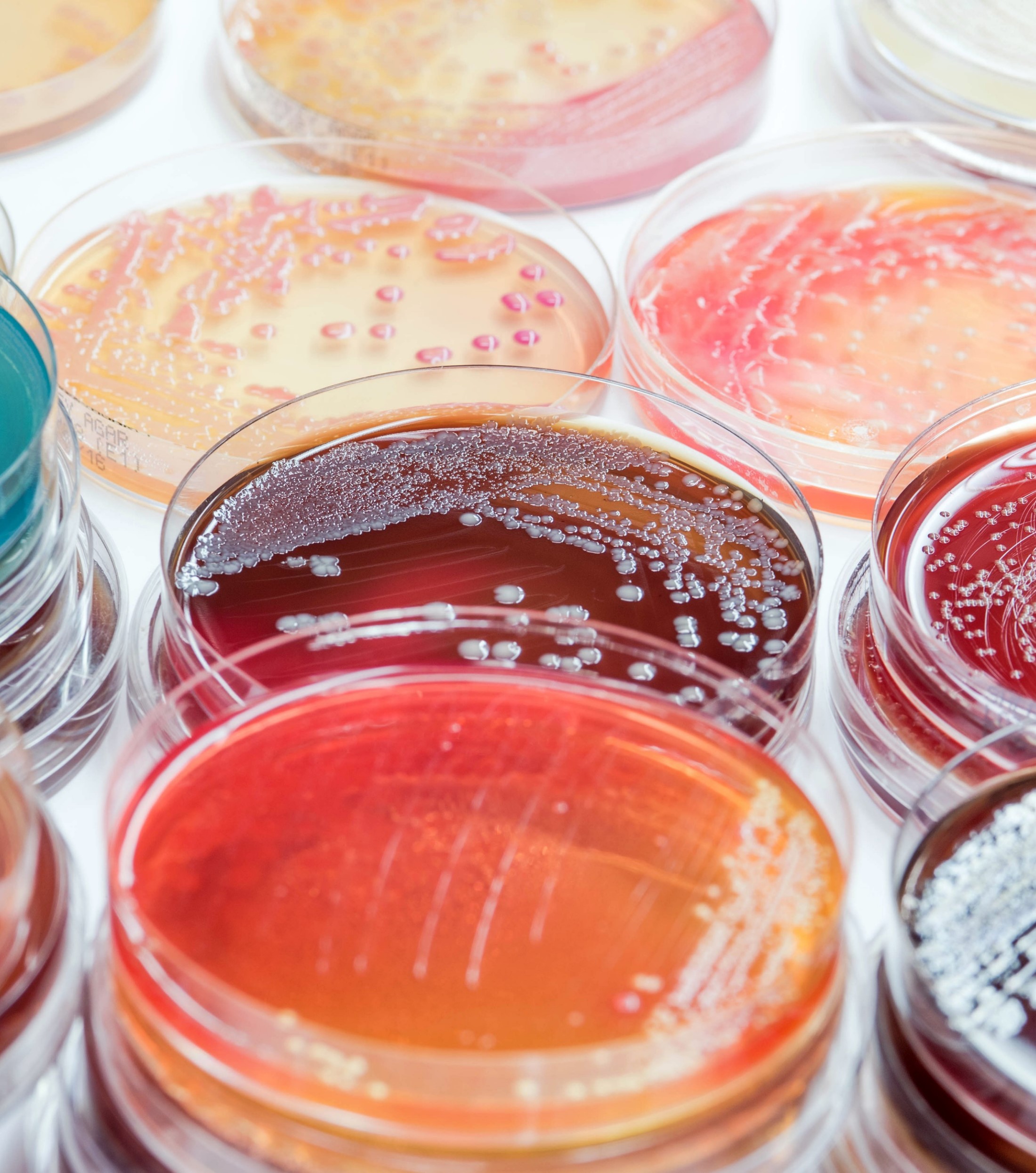 Análisis Microbiológico | Instituto Especializado de Análisis (I.E.A.)